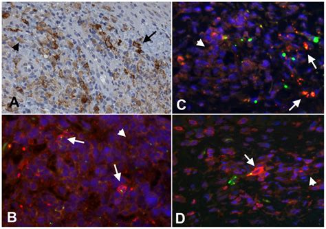 Dermal Dendritic Cells In The Dermal Epidermal Zone Of The Download Scientific Diagram