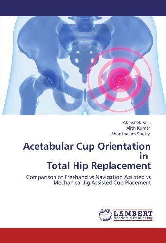 Buy Acetabular Cup Orientation In Total Hip Replacement Comparison Of Freehand Vs Navigation