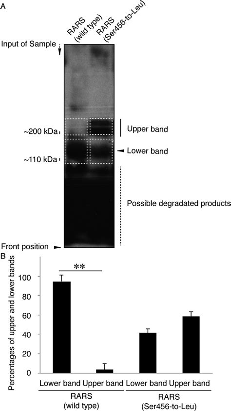 Hypomyelinating Leukodystrophy Associated Mutation Of Rars Leads It To