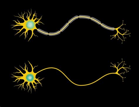 Top 10 Neuralink Innovations Brain Tech Breakthroughs