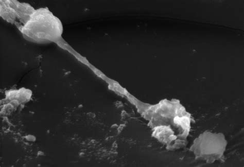 Scanning Electron Micrographs Of Neutrophils Stimulated With Moi 1 10 Download Scientific