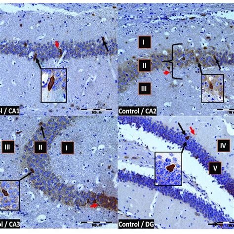 Control Group Immunoreactivity Of Pv Ir Neurons In The Fields Ca1 Ca3 Download Scientific
