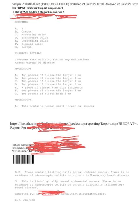 Diagnosed Indeterminate Colitis Years Ago Recent Colonscopy Pathology