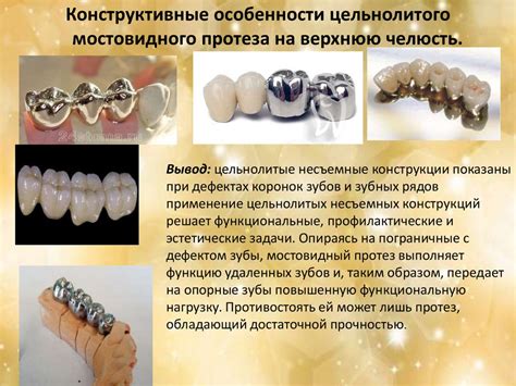 Изготовление цельнолитого мостовидного протеза на верхнюю челюсть анализ возможных ошибок