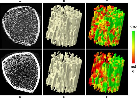 Comparison Of Trabecular Bone Tb Microstructure Using Micro‐ct And Ct Download Scientific