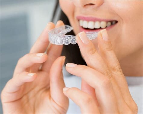 Importance Of Invisalign Dental Careers