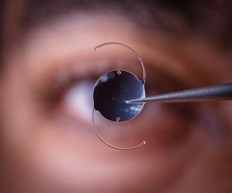 Choosing The Right Intraocular Lens