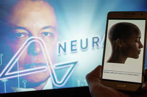 Neuralink Receives Fda Approval Musk Brain Implant Startup Explained