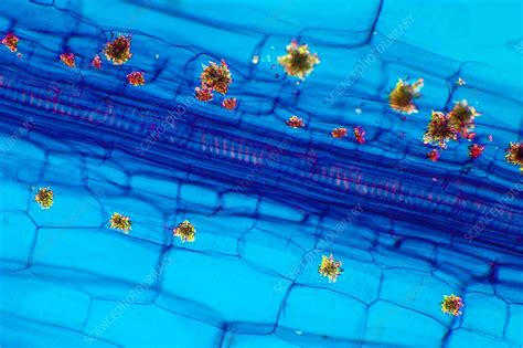 Rhubarb Leaf Light Micrograph Stock Image C003 4148 Science Photo Library