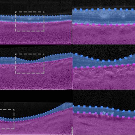 Example Segmentation Outputs From The R2 U Net 3 Layer Variant For