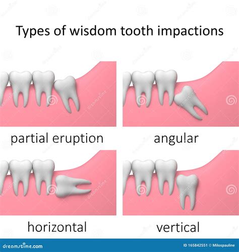 Types Of Tooth Realistic Various Human Tooth With Roots Molars