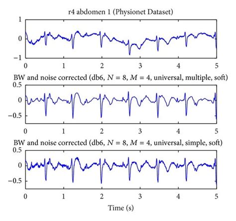 R4 Abdomen 1 Abdominal And Direct Fetal Electrocardiogram Database Download Scientific Diagram