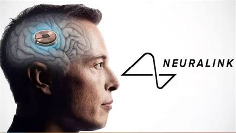 La Puce Neuralink Bientôt Dans Ton Cerveau 🧠