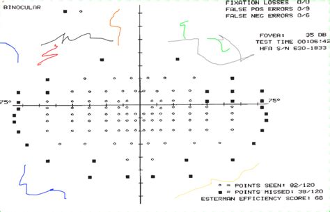 Java Finding Pattern Of Points In An Another Image Opencv Stack Overflow