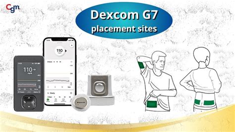 Dexcom G7 Placement Sites Thigh Arm Or Abdomen 2023