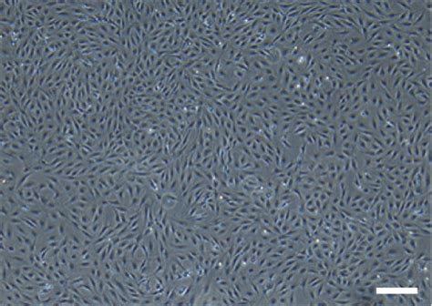 Morphology And Characterization Of BMSCs NPCs And BMSC Exos A Download Scientific Diagram