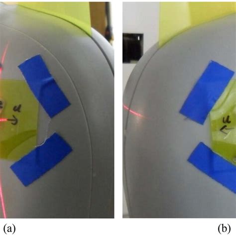 Set Up Used For Detailed In Phantom Dose Measurements At Gantry 1 The Download Scientific