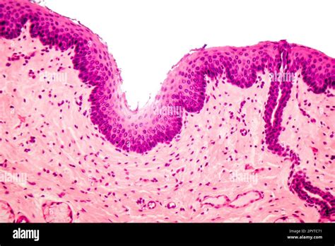Human Stratified Squamous Epithelium Under Microscope Light Micrograph