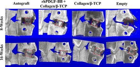 Representative μct Cross‐sectional Sagittal Plane Reconstructions Of