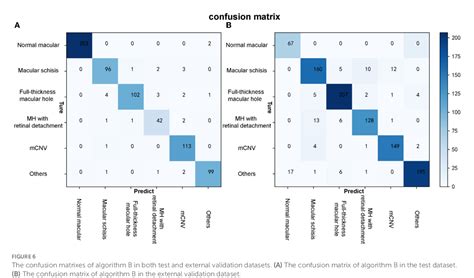Figure 6 From Development Of A Deep Learning Algorithm For Myopic Maculopathy Classification