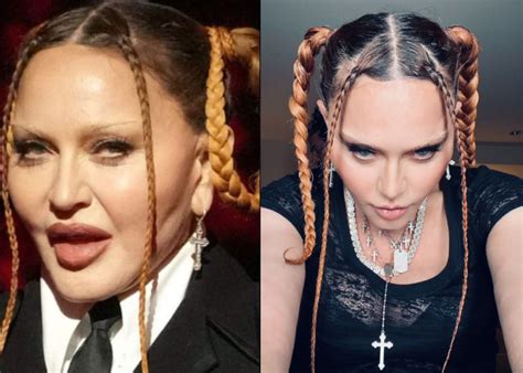 Madonnas Clap Back At Tweets Trolling Her Facelift Fails To Land