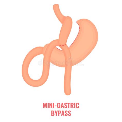 Gastric Bypass Icon Stock Illustrations 69 Gastric Bypass Icon Stock