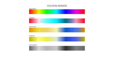 Protanomaly And Protanopia Stock Vector Illustration Of Plate 305927814