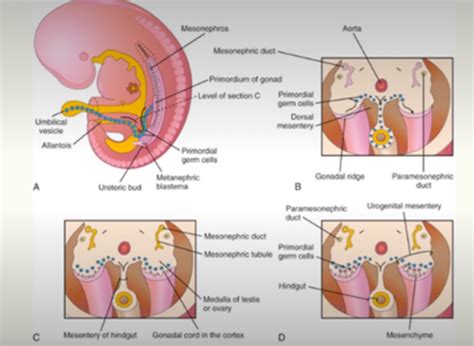 Lecture 14 Genital Tract Development Disorders Flashcards Quizlet