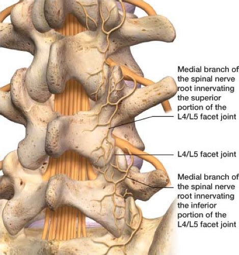 Facet Joint Procedures Facet Joint Injections Medial Branch Blocks And Radiofrequency