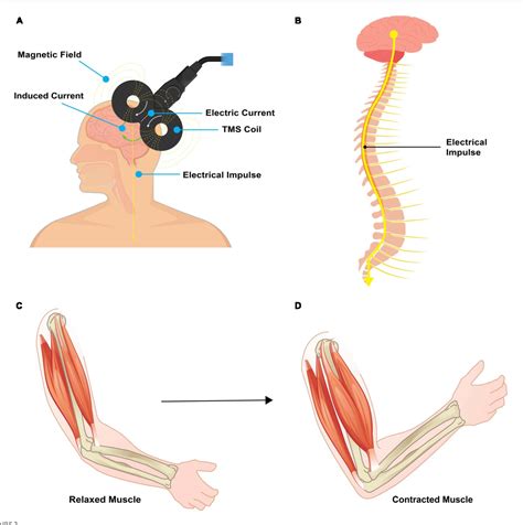 Figure 2 From A Review Of Combined Neuromodulation And Physical Therapy Interventions For
