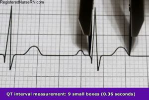 QT Interval On ECG EKG Explained