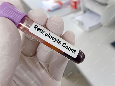 Labcorp Test Code For Reticulocyte Count At Gabrielle Pillinger Blog