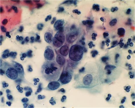 Cervical Cytology Emodule On Cervical Cytology