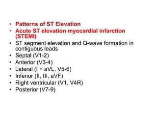St Segment In Ecg St Elevation And St Depression Pptx