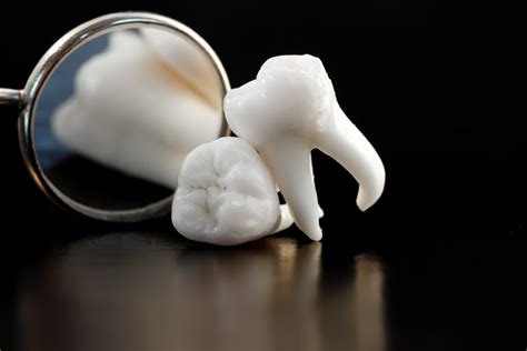 When Should Those Wisdom Teeth Come Out Austin Dental Center
