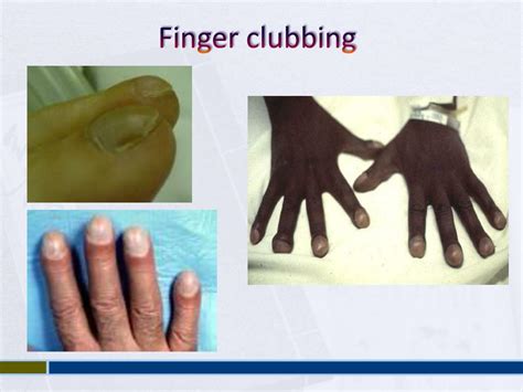 Ppt Respiratory System Physical Examination Powerpoint Presentation