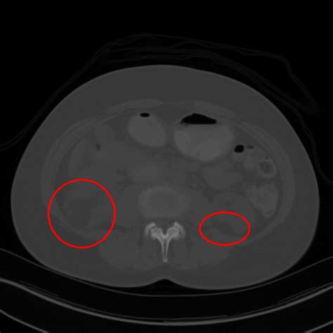 Ct Images Under Different Window Level And Window Width A Is The Download Scientific Diagram