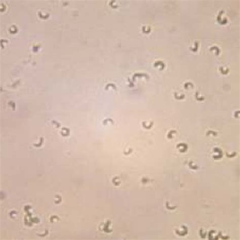 Growth Rate μ Of P Subcapitata 72 H After Ecotoxicological Bioassay Download Scientific