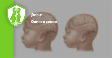 Олигофрения: что это, симптомы, причины, особенности, как лечить ...