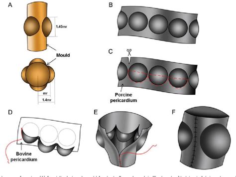 Figure 1 From Anticalcification Effect Of A Combination Of