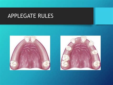 02 Kennedy Classification Pptx Dental Health Diseases And Conditions 02 Kennedy Classification Pptx Dental Health Diseases And Conditions