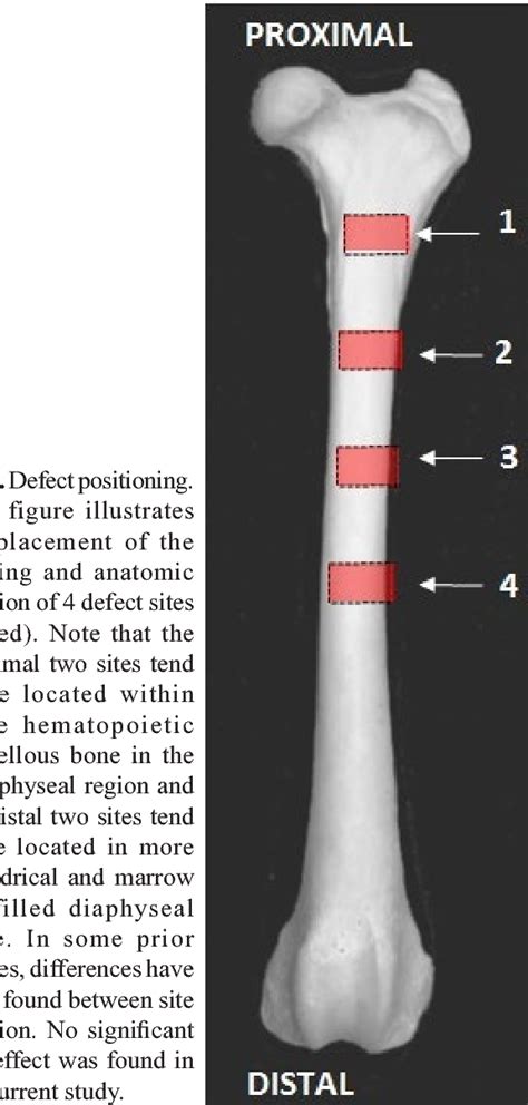 Figure 1 From Evaluation Of Rhbmp 2collagentcp Ha Bone Graft With And Without Bone Marrow