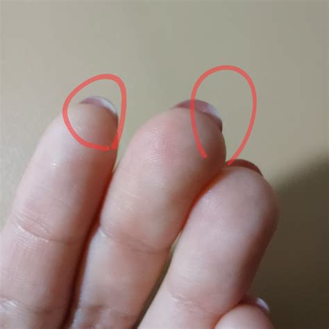 問題 這樣算指甲發霉嗎？ 美甲板 Dcard
