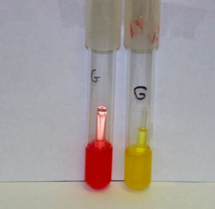 Microbiology Lab Practicum 3 Flashcards Quizlet Microbiology Lab Practicum 3 Flashcards Quizlet