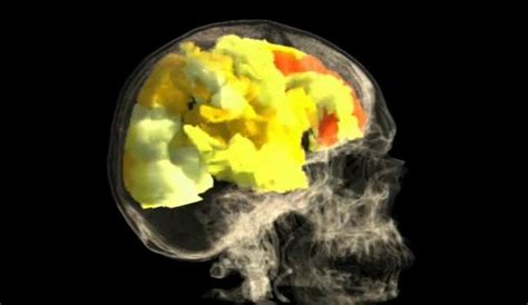 Como funciona o cérebro de uma mulher durante o sexo TecMundo