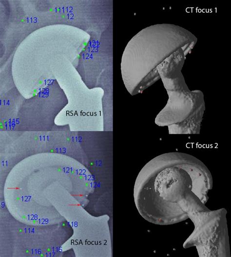 The Isosurface Level For The Ct Volumes Is Set Such That Only Metal Is Download Scientific