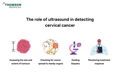 Can Ultrasound Detect Cervical Cancer Thomson Medical