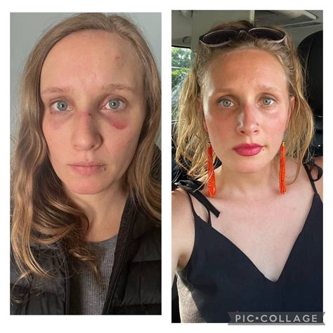 Before And After Alcohol