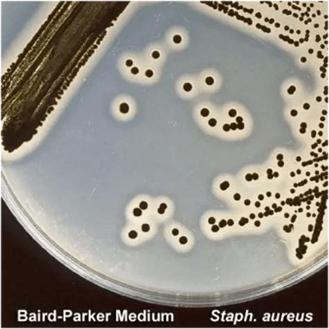 Baird Parker Agar Preparation Composition And Uses • Microbe Online
