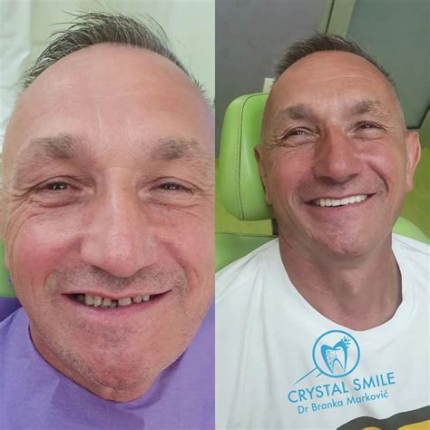 Pukao Stomatološka Ordinacija Marković Dr Branka Brčko Facebook